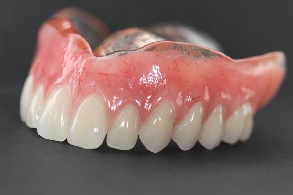 Próteses Removíveis - Adriana Lànger | Odontologia Estética